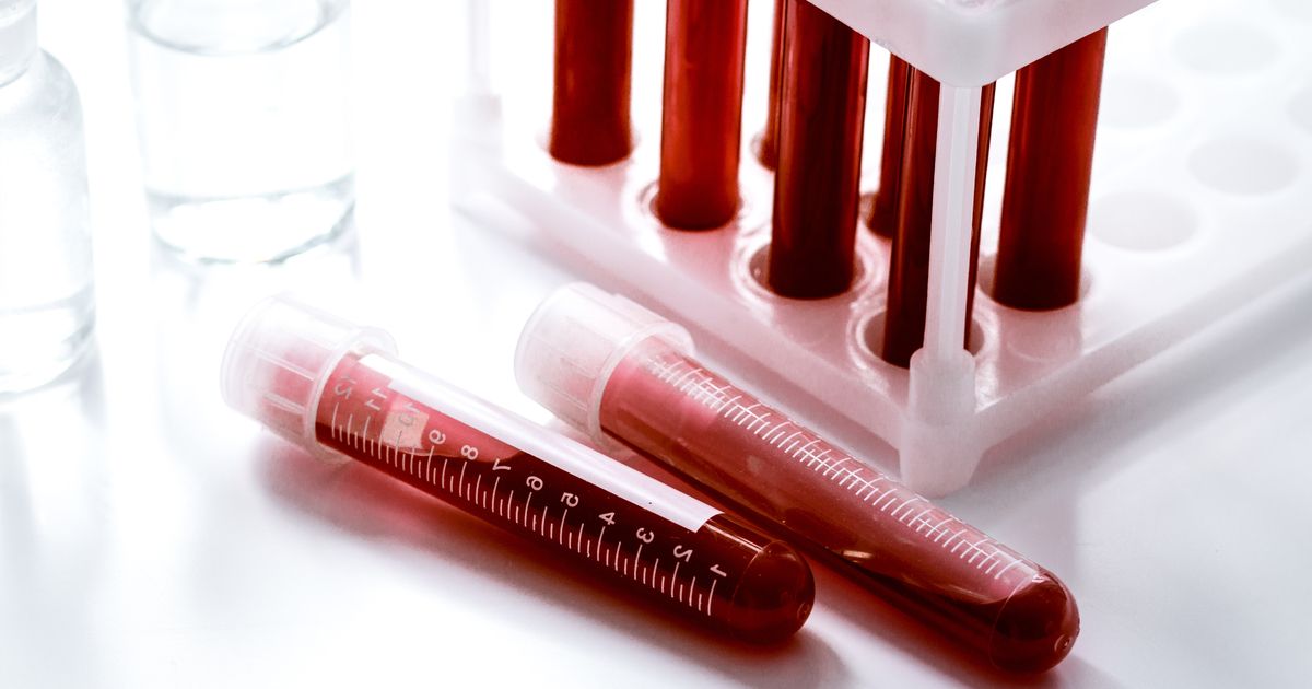 Researchers Laud First Prospective Evidence of Functional Precision ...