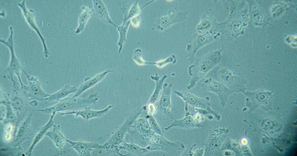 Pfizer's Lorbrena Produces Longest Progression-Free Survival Seen in ...
