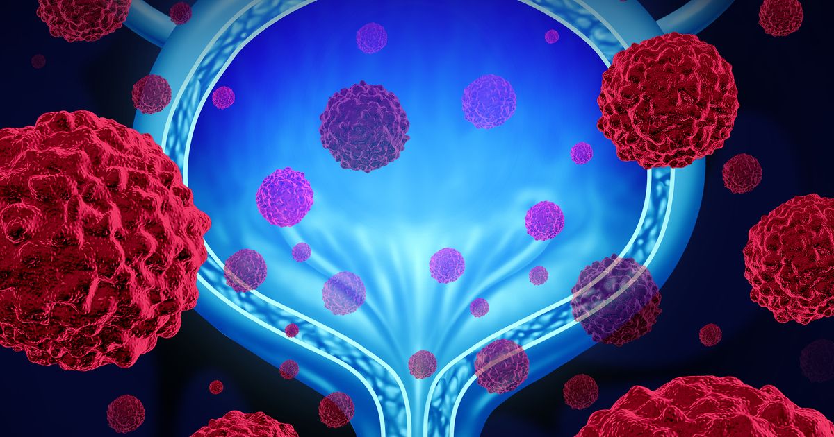 UPenn Researchers Find Low Uptake of Janssen's Balversa in Eligible ...