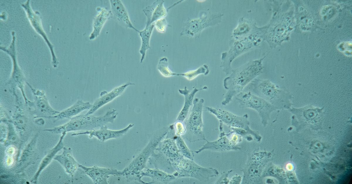 ASCO Study Details Activity of Amgen's Lumakras, First Approved KRAS ...