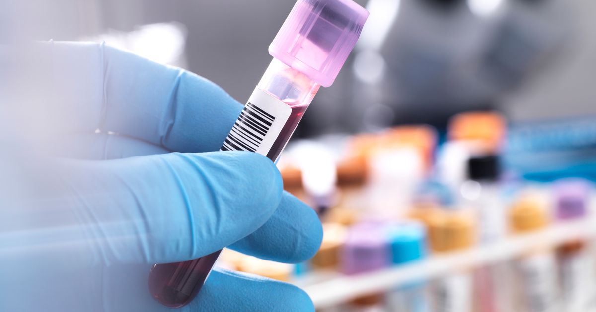 University of Helsinki Spinout Developing Blood Test to Tailor ...