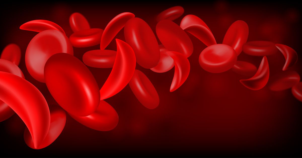 ASH24 Gene Therapy Readouts in Sickle Cell, TDT: Editas, Vertex, Beam ...