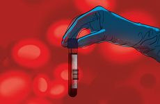 Researchers in Taiwan Suggest a New CA19-9 Threshold Could Identify ...